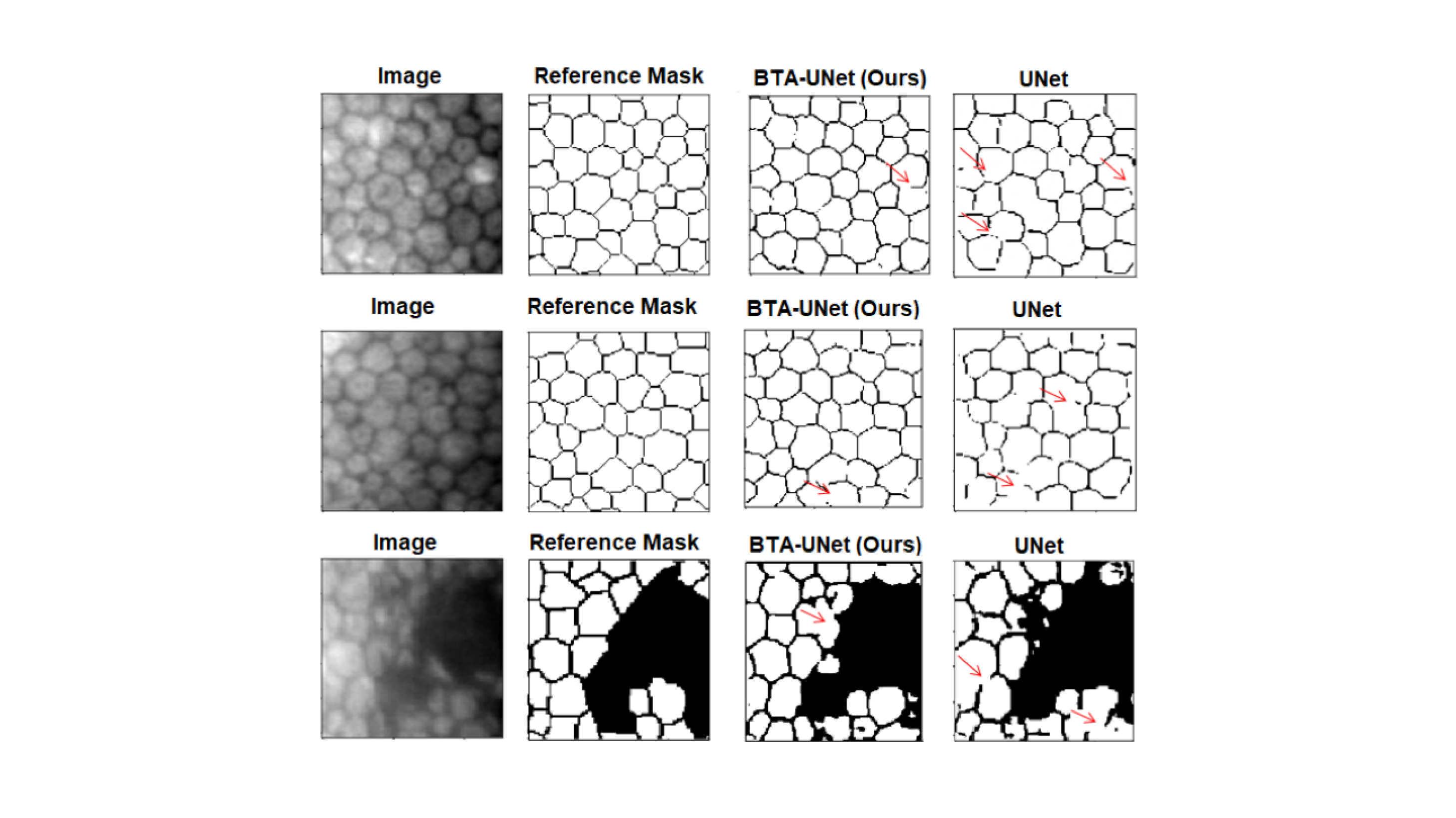 Self-supervised Deep-Learning Segmentation of Corneal Endothelium Specular Microscopy Images ...